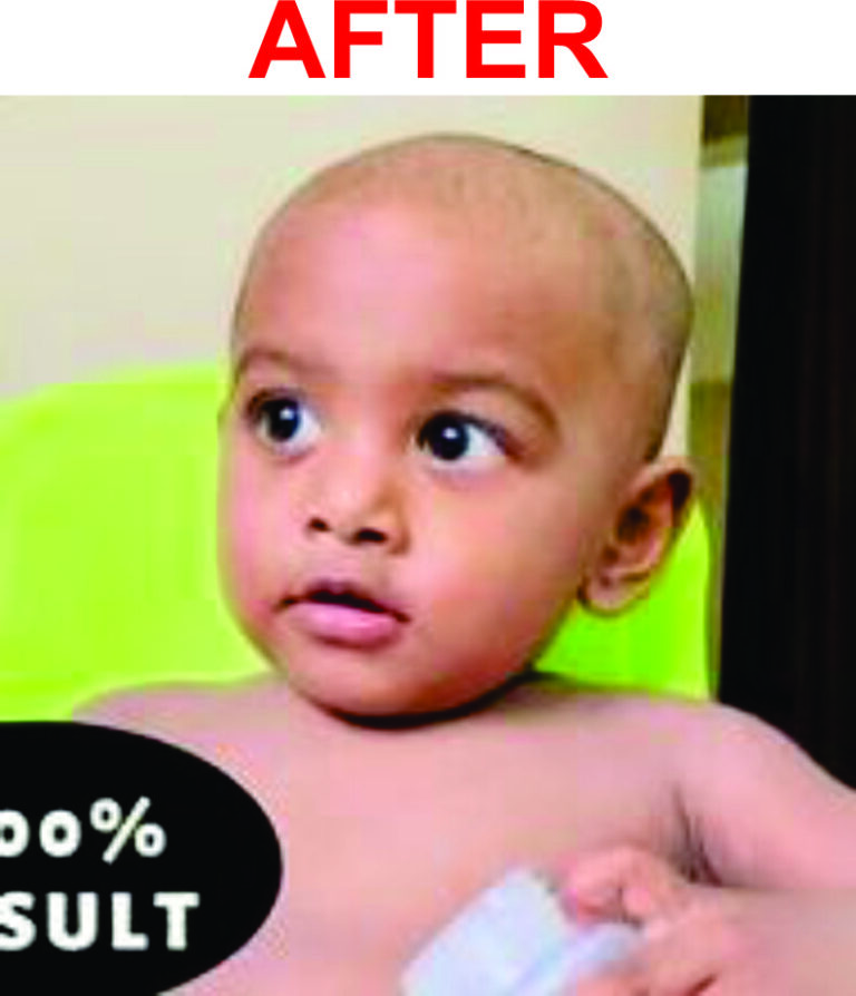 Crazy World of Mothers Desperate For Light Complexioned Children, Take ...